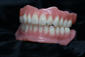 Full on Full Digital Denture - Stewart Dental Lab